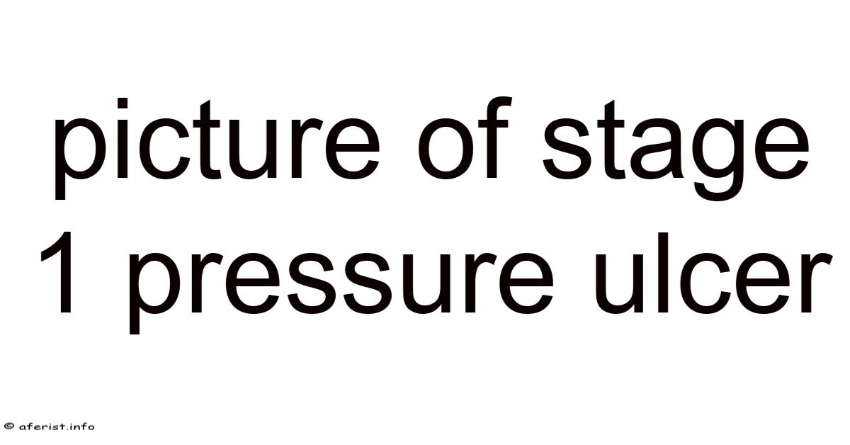 Picture Of Stage 1 Pressure Ulcer